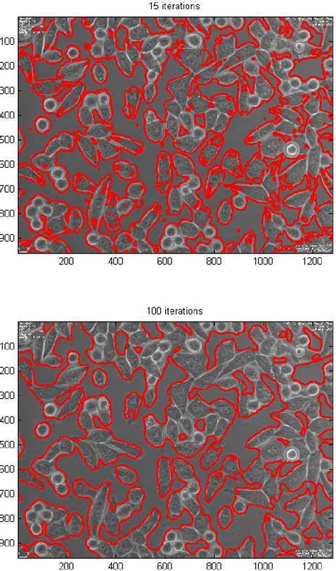Figure 14 From Segmentation Of Microscopic Images Using Level Set