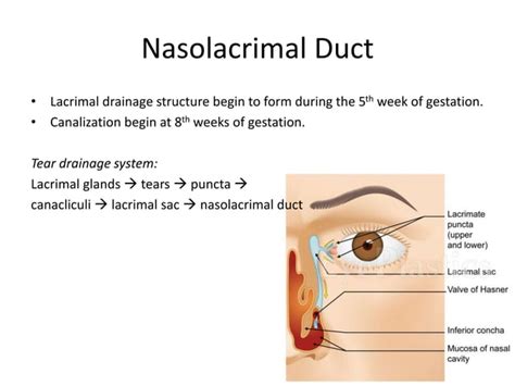 Nasolacrimal Duct Obstruction Pptx