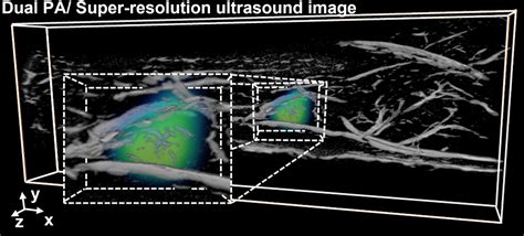 Researchers Develop New Lower Cost Dual Modality Imaging Technique To