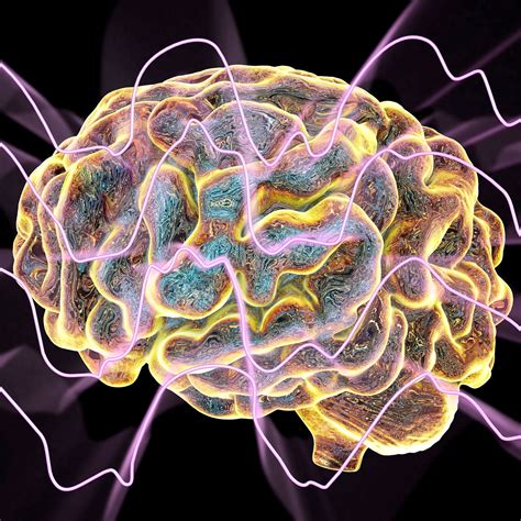 Exploding Head Syndrome Inside A Mysterious Disturbing Sleep Condition