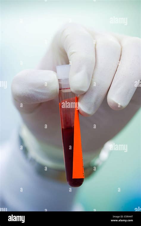 Blood Samples Used For Oncognetic Analysis Human Molecular Oncology Laboratory Of Oscar Lambret