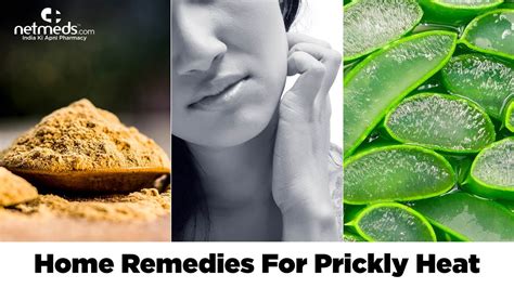 How To Make Prickly Heat Rash Go Away At Arlene Jordan Blog
