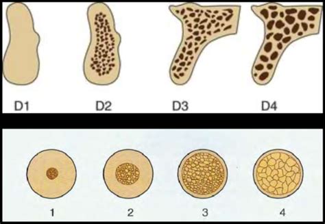 Dmd6360 Course Overview Powerpoint Flashcards Quizlet