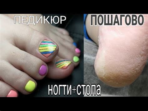 Классический педикюр пошагово использование лезвия, кератолитика для ...