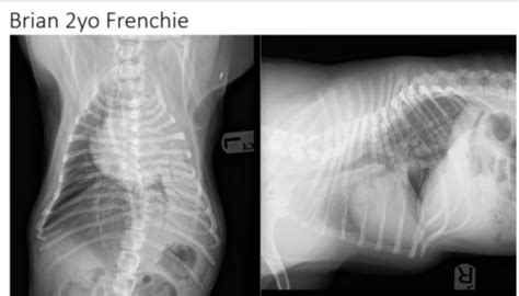 Imaging Lung Patterns Flashcards Quizlet