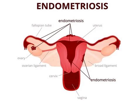 Dr Rakshitha Shetty Obstetrician And Gynecologist Infertility