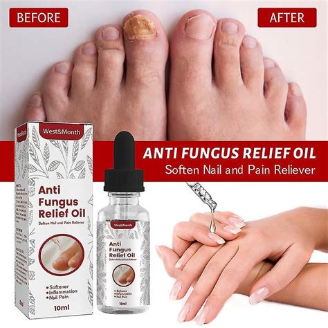 Nail Fungus Oil Hand Foot Repair Serum Against Toenail Fungus Anti Infective Onychomycosis