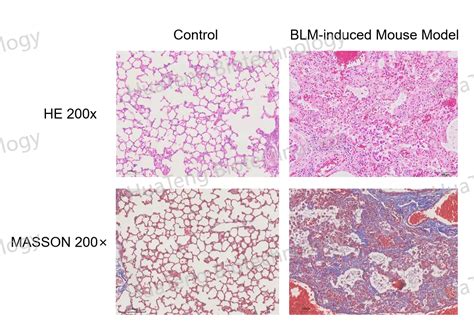 Bleomycin Induced Pulmonary Fibrosis Mouse Model