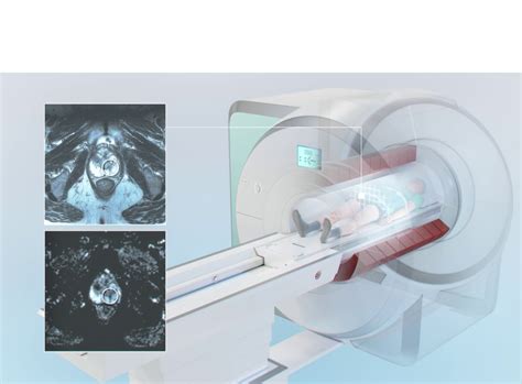 Prostate Cancer Diagnosis Soteria Medical