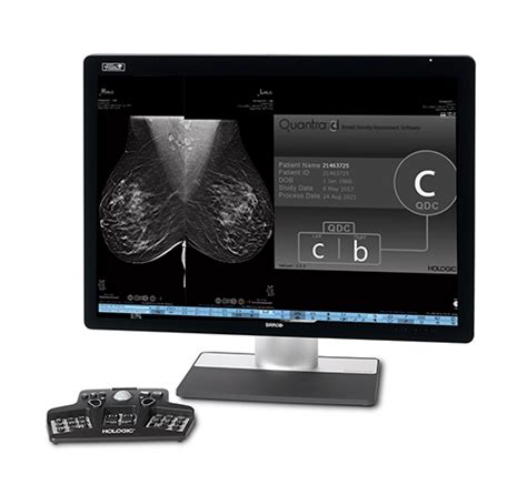 Quantra® 2 2 Breast Density Assessment Software Hologic