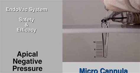Endodontic Irrigation Endovac Irrigation System Safety And Efficacy Odonto Tv