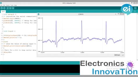 Low Cost Ad8232 Based Ecg And Heart Monitoring System Using Arduino Electronics Innovation