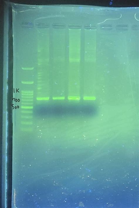 This Is Nrl Coding Sequence Electrophoresis Result It Should Appear At
