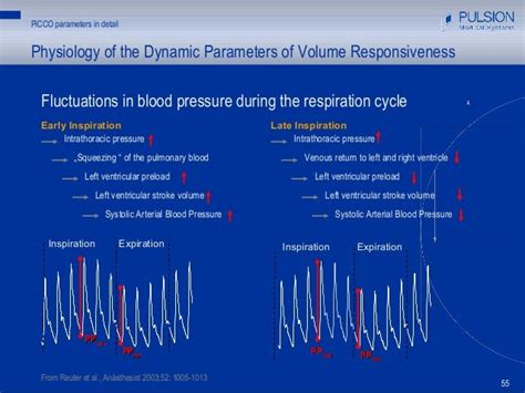 Physiology Of Hemodynamics And Picco Parameters In Detail