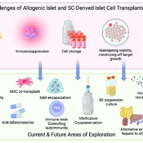Ongoing Challenges To Allogenic And Stem Cell Sc Derived Islet Download Scientific Diagram