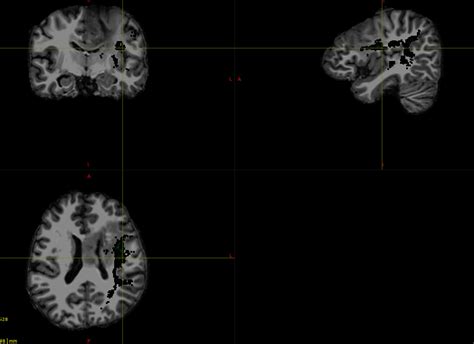 Tck To Vtk Transform Error Mrtrix3 Community