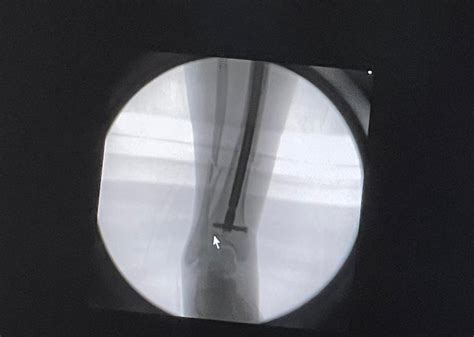 Received 212848298240164 Jpeg