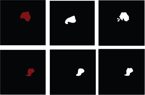 Comparison Of Model Segmentation Effects Before And After Data Set Download Scientific Diagram