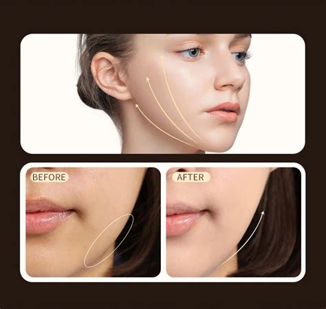 사용 Rf 미용 기기 Ems Rf 미용 장치 얼굴 리프팅 장치 블루 라이트 피부 강화 홈 여드름 치료 플라즈마 펜 Ozono
