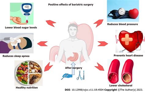 Outcomes And Effects Of Bariatric Surgery Download Scientific Diagram
