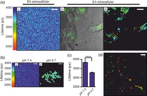 Probing Amyloid Protein Aggregation With Optical Superresolution Methods From The Test Tube To