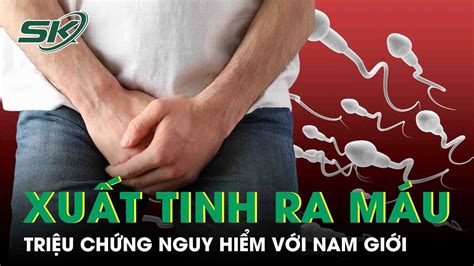 Đi Tìm Căn Nguyên Xuất Tinh Ra Máu SKĐS YouTube