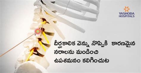 Facet కీళ్ళ వ్యాధి Facet Joint Arthropathy లక్షణాలు కారణాలు మరియు