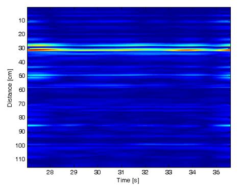 Extracted Breathing Movement After Inverse Fourier Transform Antenna Download Scientific