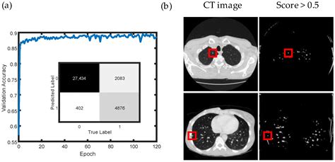 Pulmonary Nodule Detection And Classification Using All Optical Deep