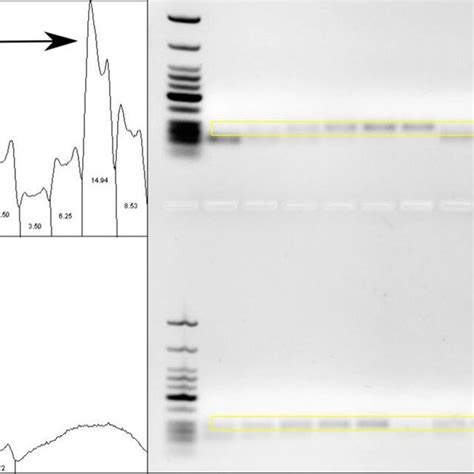 Imagej Software Analysis Of The Methylated Mgmt Promoter Msp