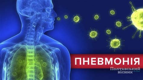 ПРОФІЛАКТИКА ПНЕВМОНІЇ | "Полтавський вісник" — новини Полтави і Полтавщини