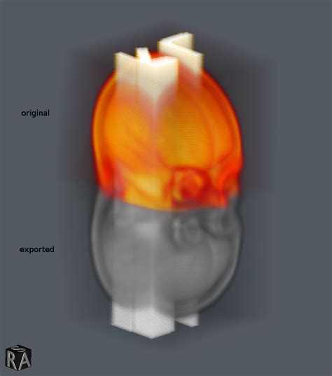 Nifti Rpi Orientation File Exported To Dicom Wrong Orientation Itk