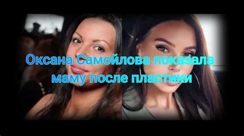 Оксана Самойлова показала маму после пластики Youtube