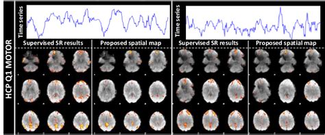 Comparison Of The Spatial Maps Between St Cnn Results And Supervised Download Scientific