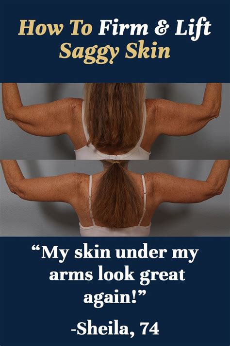 Best Cream For Crepey Skin On Upper Arms Uk In The Sea Portal