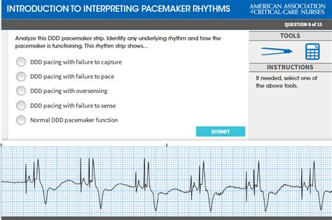 Solved Analyze This Ddd Pacemaker Strip Identify Any