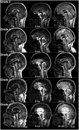 IMRI Investigative Magnetic Resonance Imaging