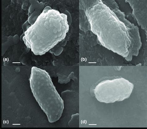 Scanning Electron Microscopy Of Suspected C Difficile Isolates
