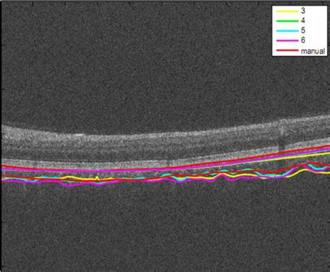 The Result Of Image Segmentation Using Manual Segmentation And Download Scientific Diagram