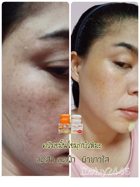 ຄິມໄຂ່ມຸກຂອງແທ້ ຄິມໄຂ່ມຸກຂອງແທ້ Added A New Photo