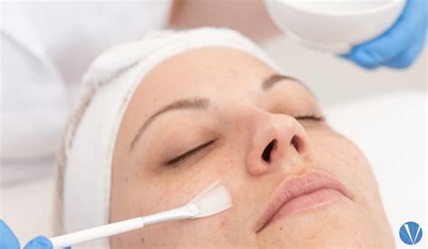 Chemical Peel Aftercare Guide Vujevich Dermatology Associates
