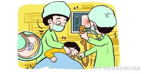 胃镜和肠镜可以一起做吗？做胃镜和做肠镜的流程分别是什么？ 知乎
