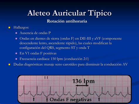 Narabar Medallista Libro Guinness De Récord Mundial Flutter Auricular Tipico Y Atipico Serpiente