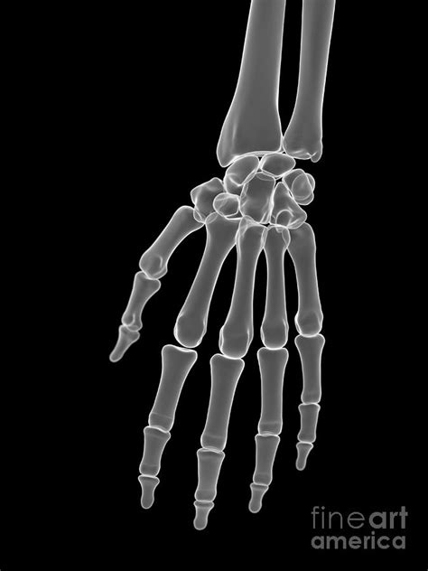 Hand Bones Photograph By Sebastian Kaulitzkiscience Photo Library Pixels