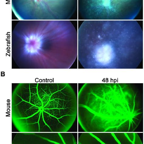 Endophthalmitis Was Induced By Intravitreal Injection Of S Aureus In