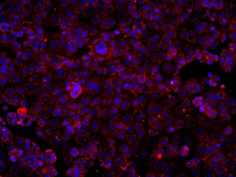 Sucla2 Antibody 68549 1 Ig Proteintech