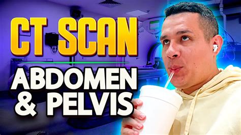CT Scan Abdomen And Pelvis With Oral Contrast Vlog YouTube