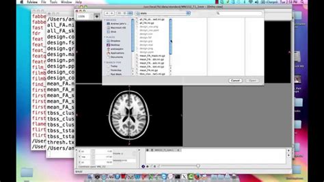 Dti Analysis Step 8 Stats Youtube