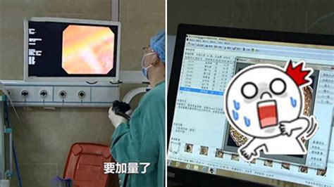 可怕女子吃两年清肠药 肠道变黑长出豹纹 手机新浪网