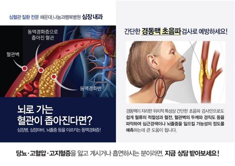 경동맥 초음파 검사를 받아야 합니다